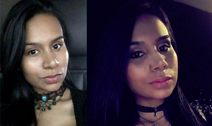 Jennifer se opera la nariz por necesidad | LatinOL.com Vida Social