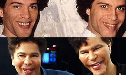 Hermanos gemelos obsesionados por la cirugía | LatinOL.com Vida Social